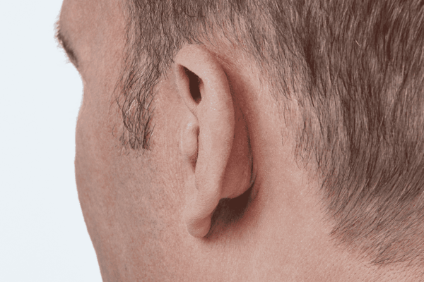 Oticon Own™ In-the-Ear Half Shell - Rishi Speech and Hearing Solutions