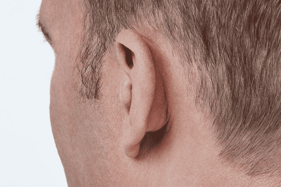 Oticon Own™ In-the-Ear Half Shell - Rishi Speech and Hearing Solutions