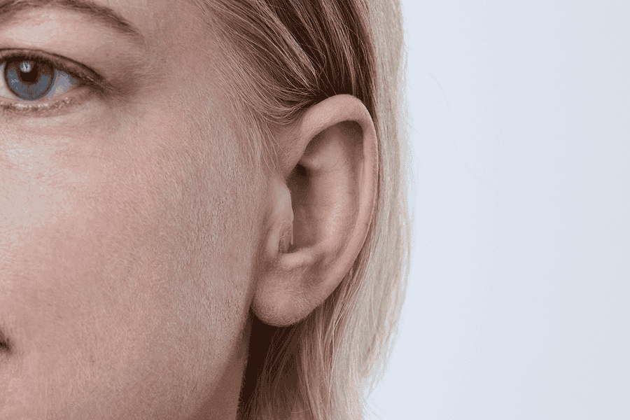 Oticon Own™ In-the-Ear Half Shell - Rishi Speech and Hearing Solutions